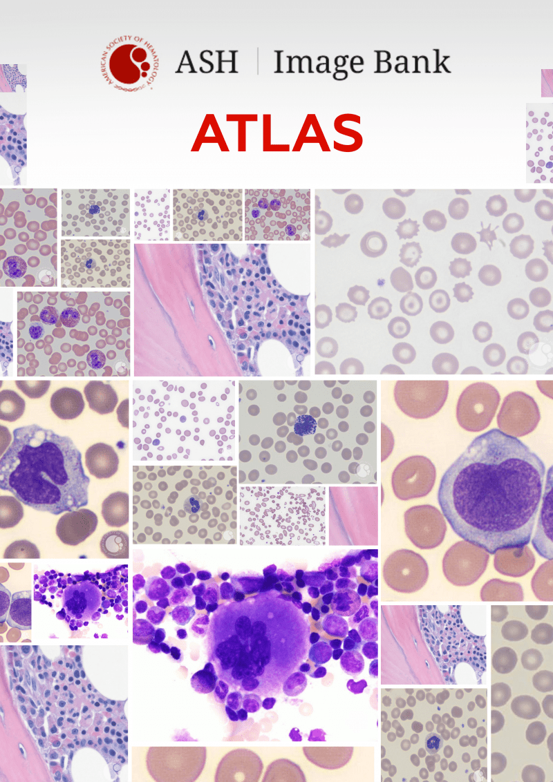 Atlas – Controllab