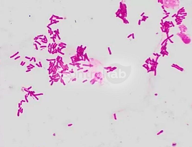 Gram Bacterioscopy – Controllab