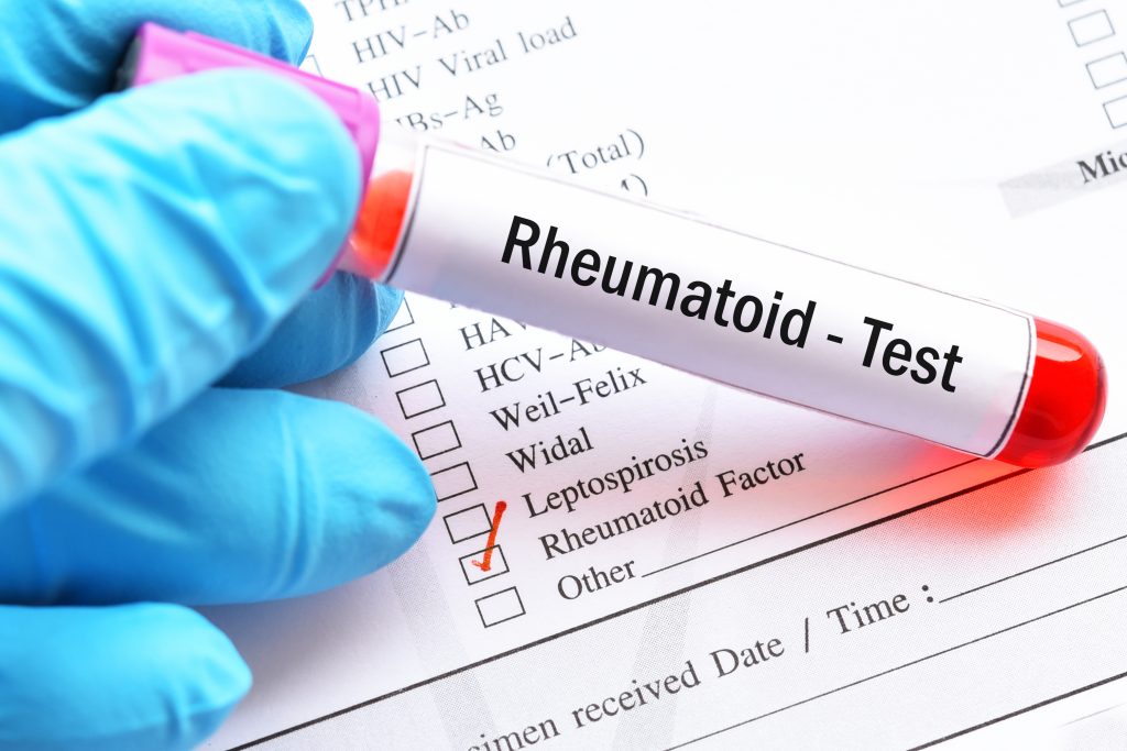 Rheumatoid Factor - Immunology Cavitary Fluids – Controllab