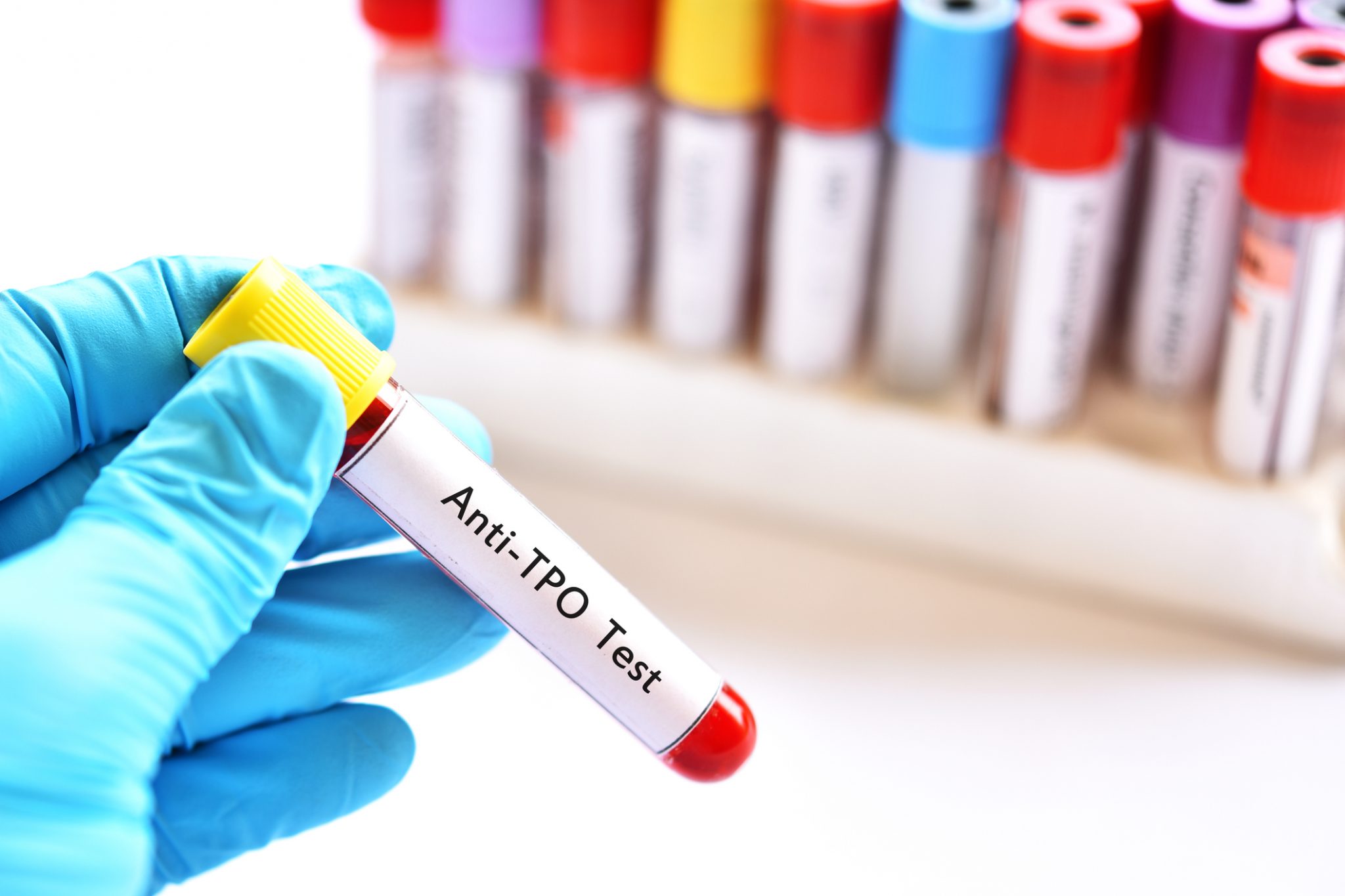 Anti-tiroperoxidasa (Anti-TPO) - Inmunología – Controllab