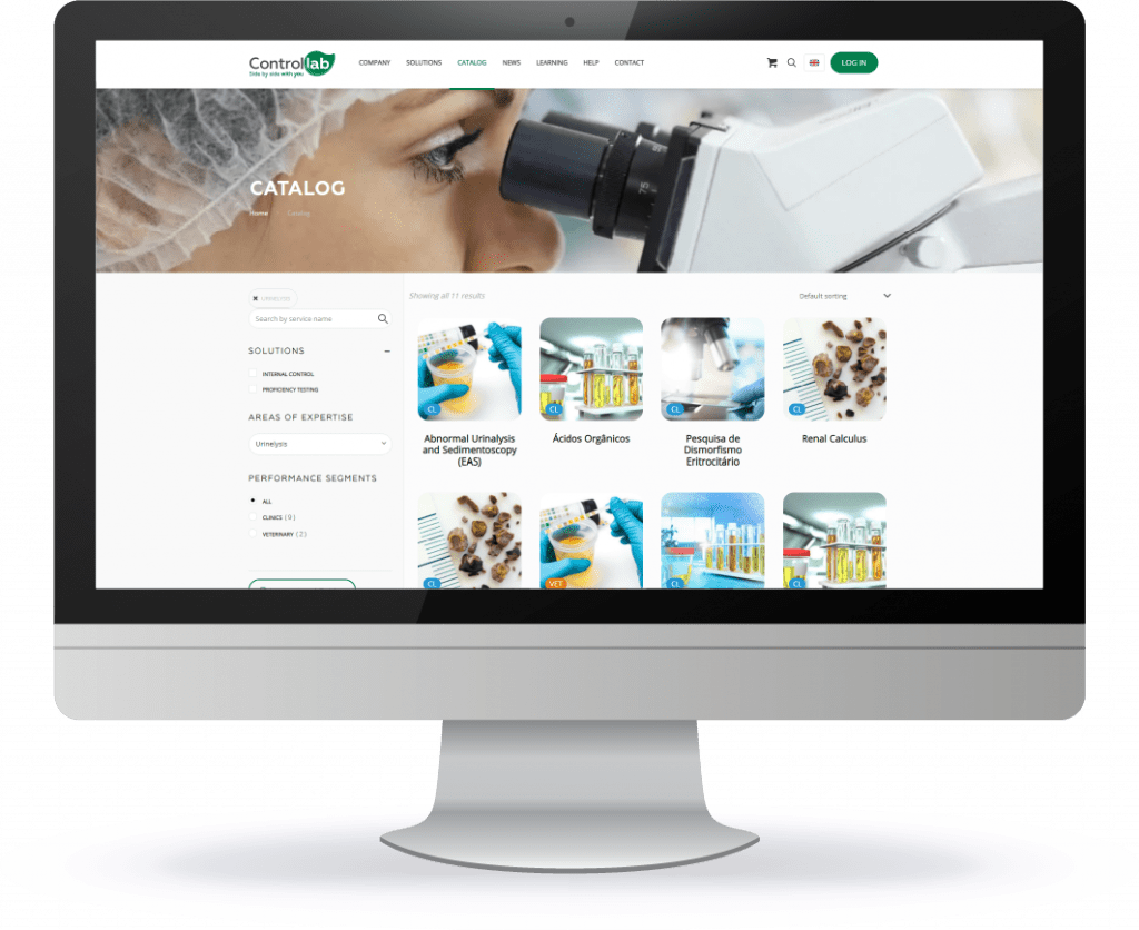 Efficiency in process control in Urinalysis