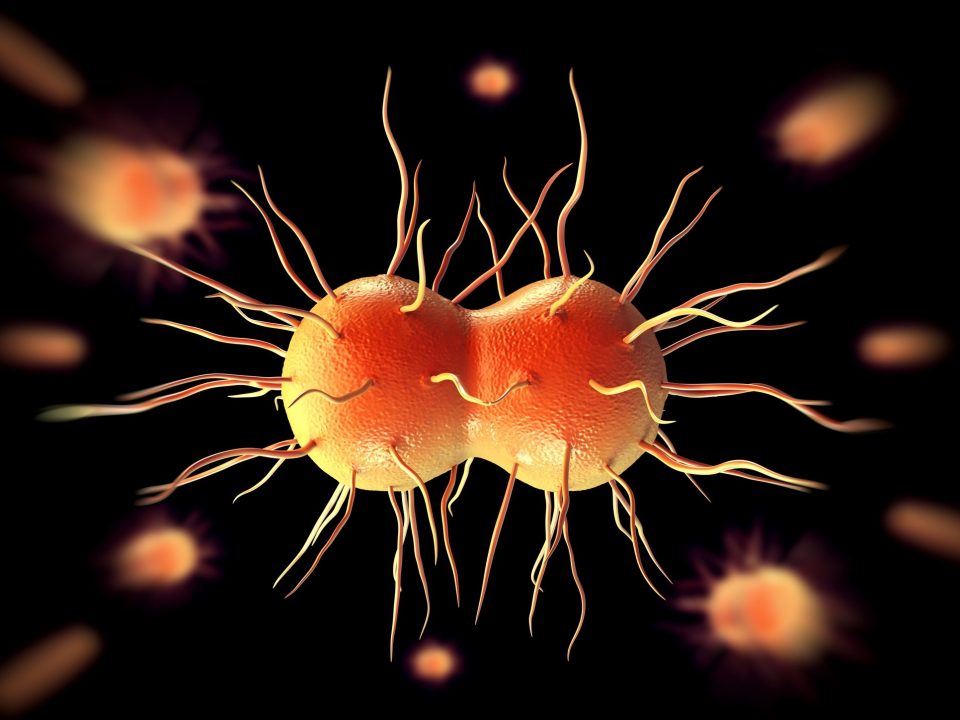 Neisseria gonorrhoeae: Culture – Controllab