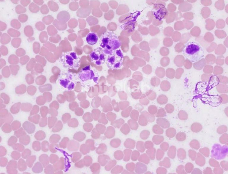 LE Cells Screening – Controllab