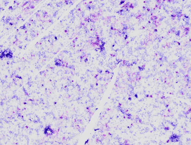 Pneumocystis jirovecii - Microscopy – Controllab
