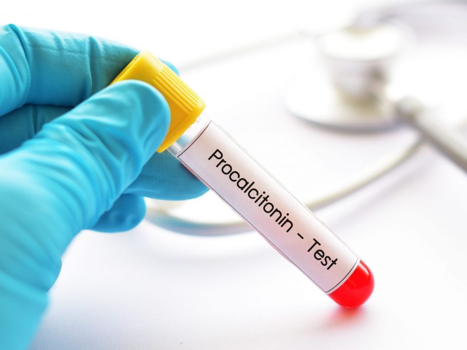 Proteína C Reactiva - Inmunología – Controllab