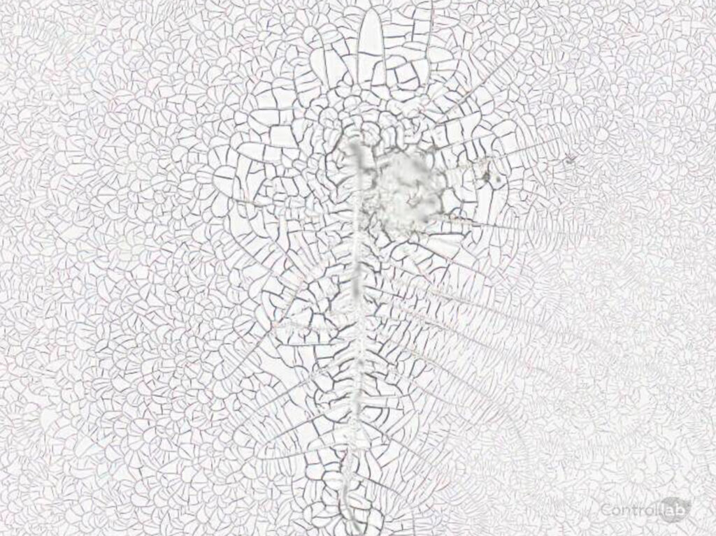 Premature Rupture of Membranes: Fern Test – Controllab