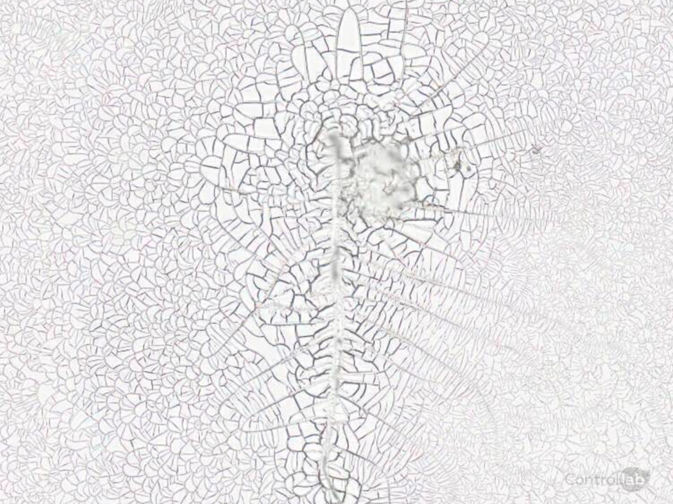 Premature Rupture of Membranes: Fern Test – Controllab