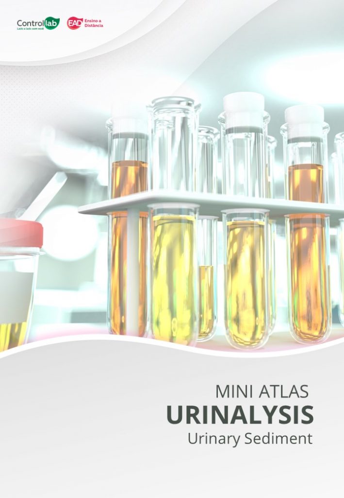 Atlas – Controllab