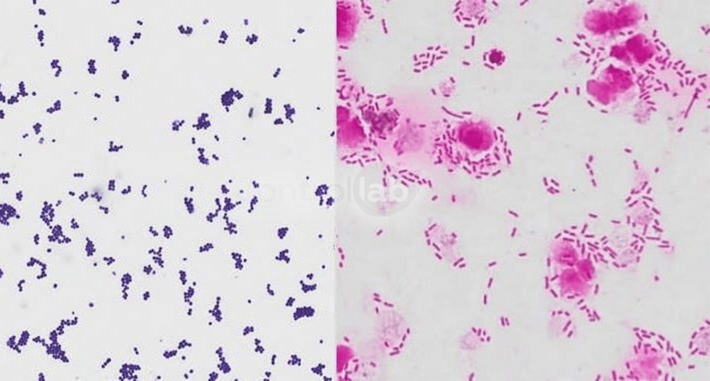 Bacterioscopia GRAM – Controllab