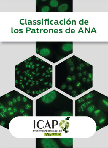 Classificación de los Patrones de ANA – Controllab