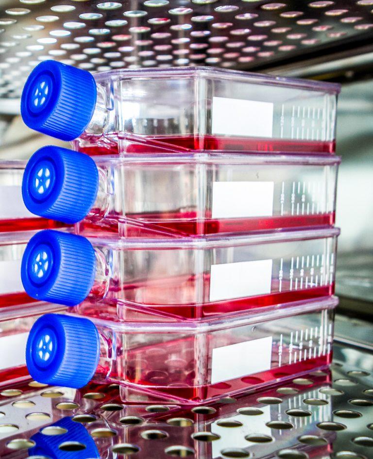 Anaerobic Blood Culture – Controllab