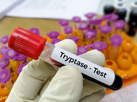 Tryptase – Controllab